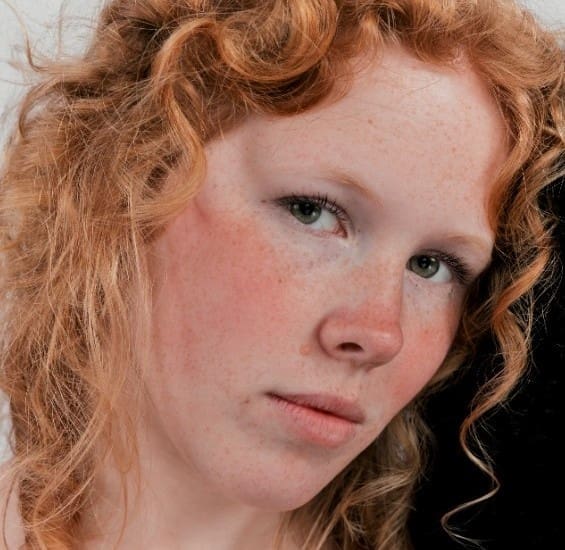 Uneven Skin Tone: Causes, Prevention and Treatments | Dr Hass Clinic